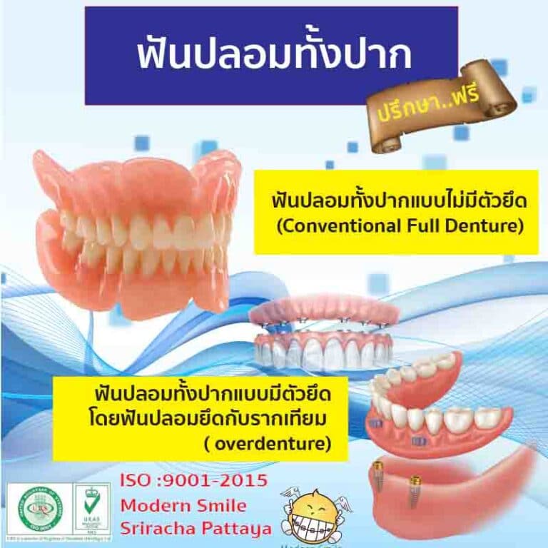 Full mouth dentures - Fixed type, fixed the implant - Modern Smile Dental